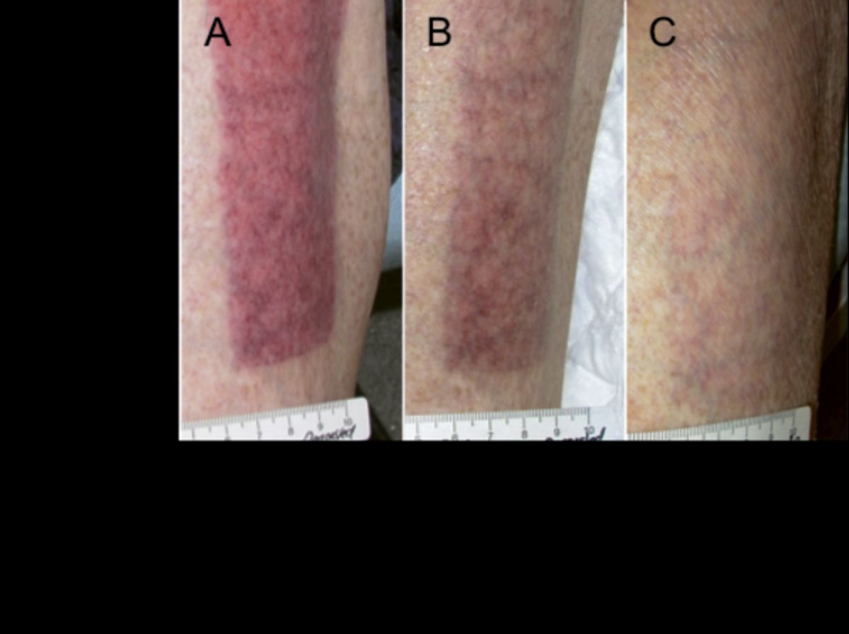 The Ultimate Guide to Post-Leg Workout Recovery: Tips and Tricks